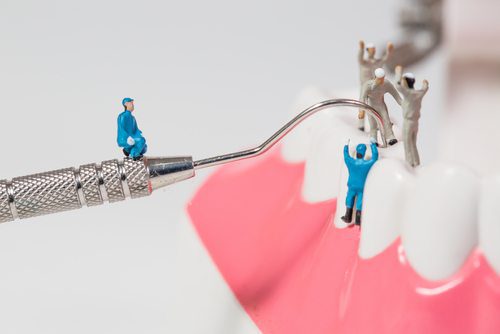 How Do You Fix A Cavity? | Arlington Heights IL Dentist